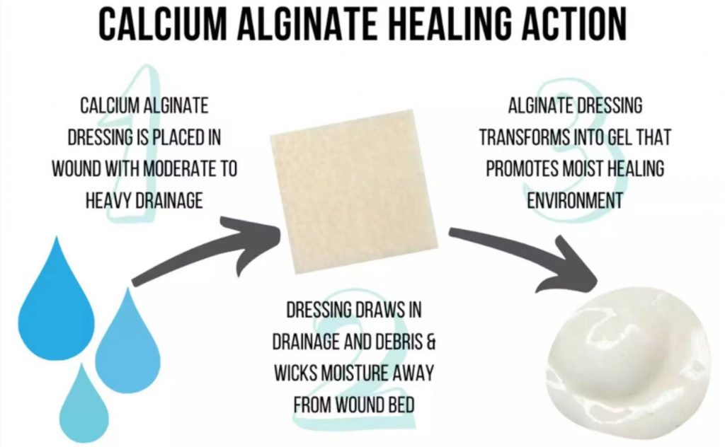 Alginate Dressing in wound treatment